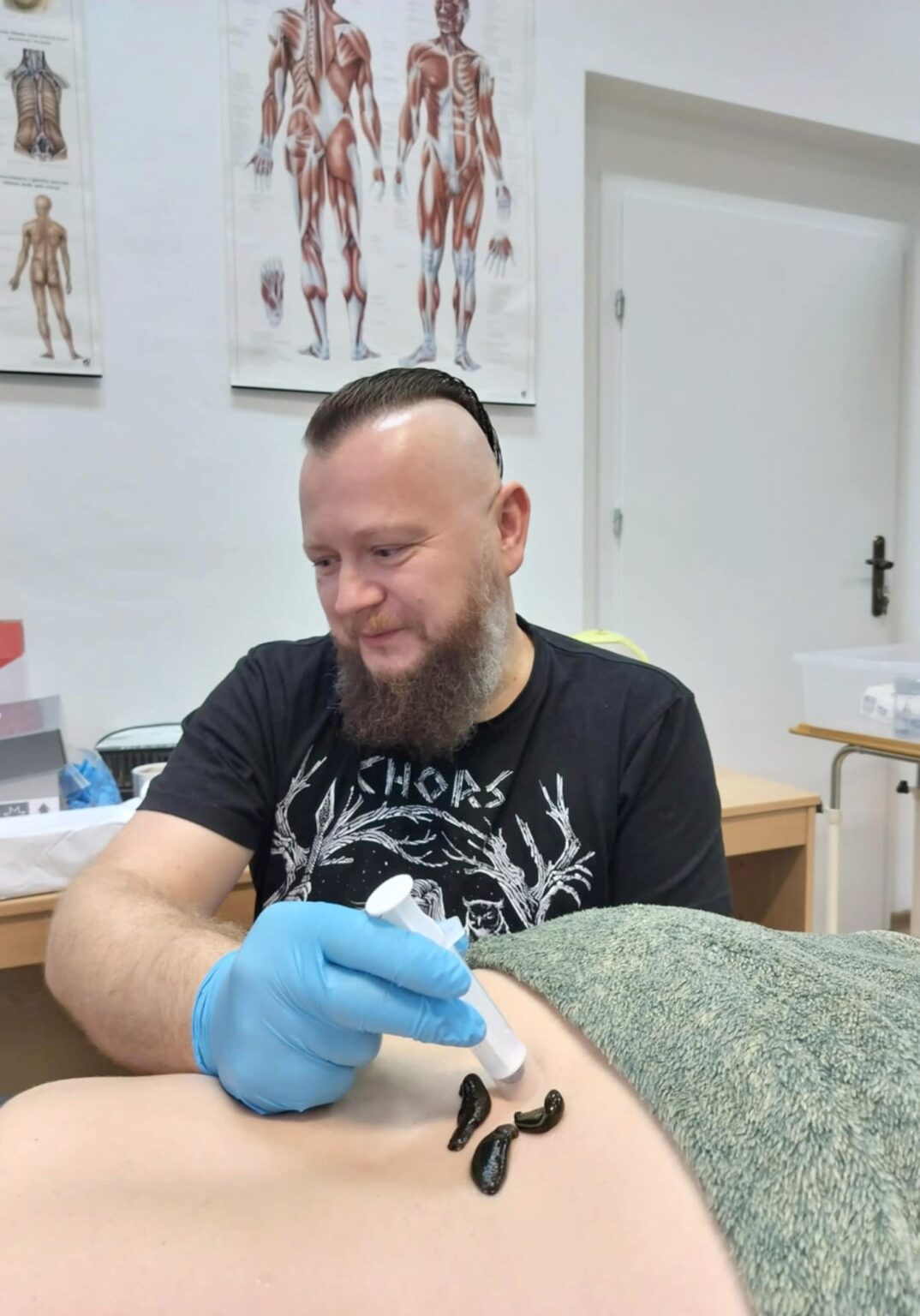 Hirudoterapia: jak działają pijawki lekarskie – jakwyleczyc.com
